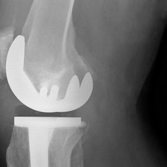 The Centers for Advanced Orthopaedics Virginia, DC, Maryland